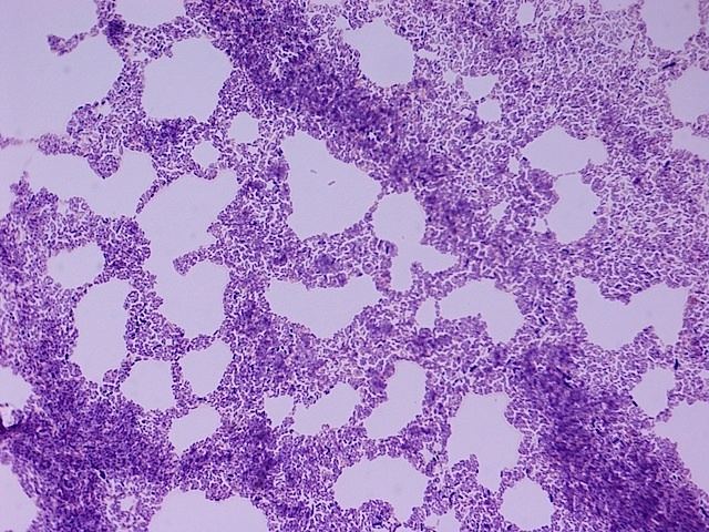 Collinsella - MRGI - Microbiota Research Group of Iran