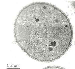 Megasphaera - MRGI - Microbiota Research Group of Iran
