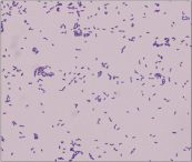 Microbacterium - MRGI - Microbiota Research Group of Iran