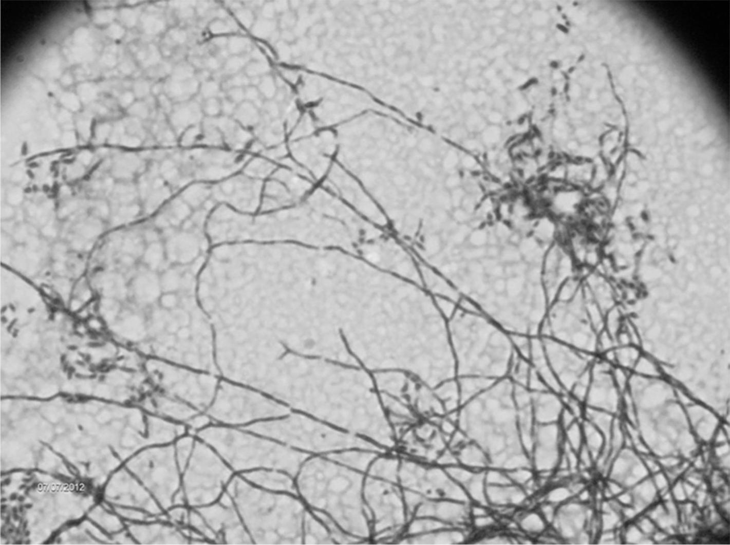 Nocardia - MRGI - Microbiota Research Group of Iran