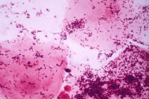 Mobiluncus - MRGI - Microbiota Research Group of Iran